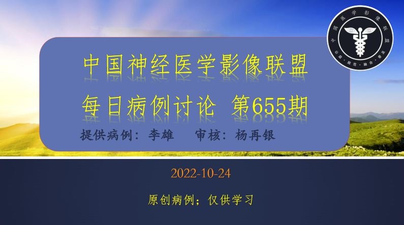 655