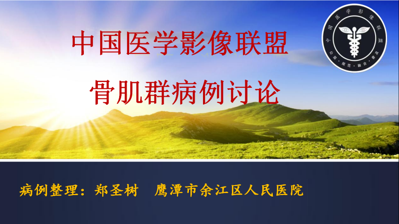2022年11月24日骨肌晚读病例:LSMFT-中国医学影像联盟-China Medical Imaging Association